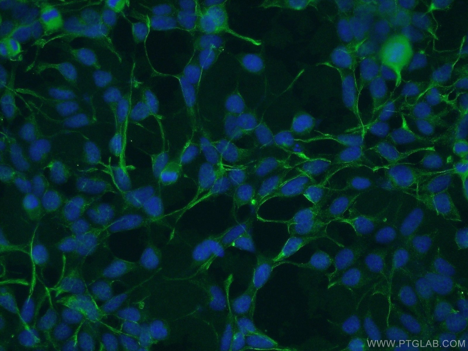 CA9 antibody (66243-1-Ig) | Proteintech