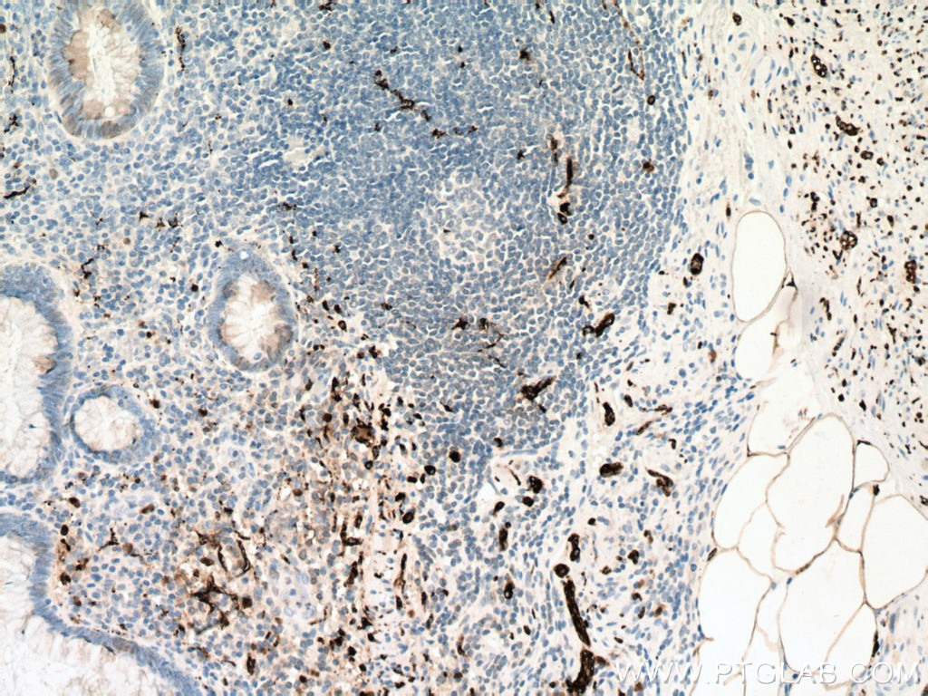 Calretinin Antibody 12278-1-AP | Proteintech