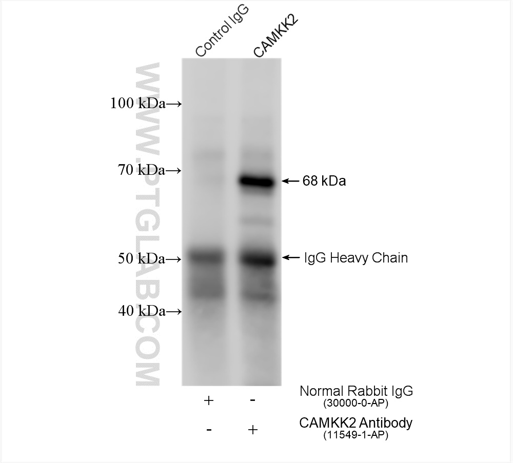 CAMKK2 antibody (11549-1-AP) | Proteintech | 武汉三鹰生物技术有限公司