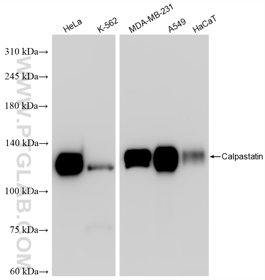 Calpastatin antibody (86664-3-RR) | Proteintech | 武汉三鹰生物技术有限公司