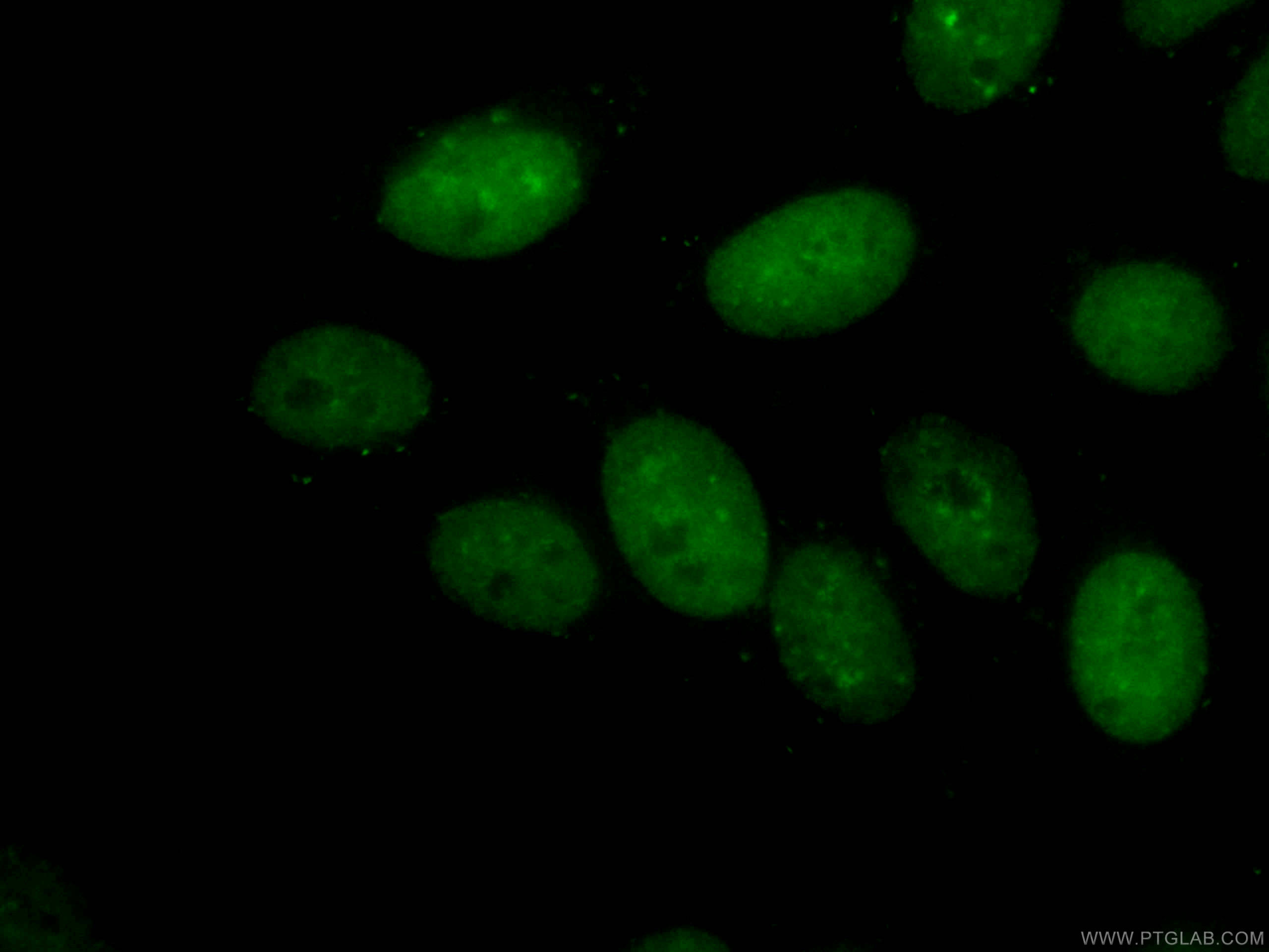CBX3 Fusion Protein Ag19112 | Proteintech | 武汉三鹰生物技术有限公司