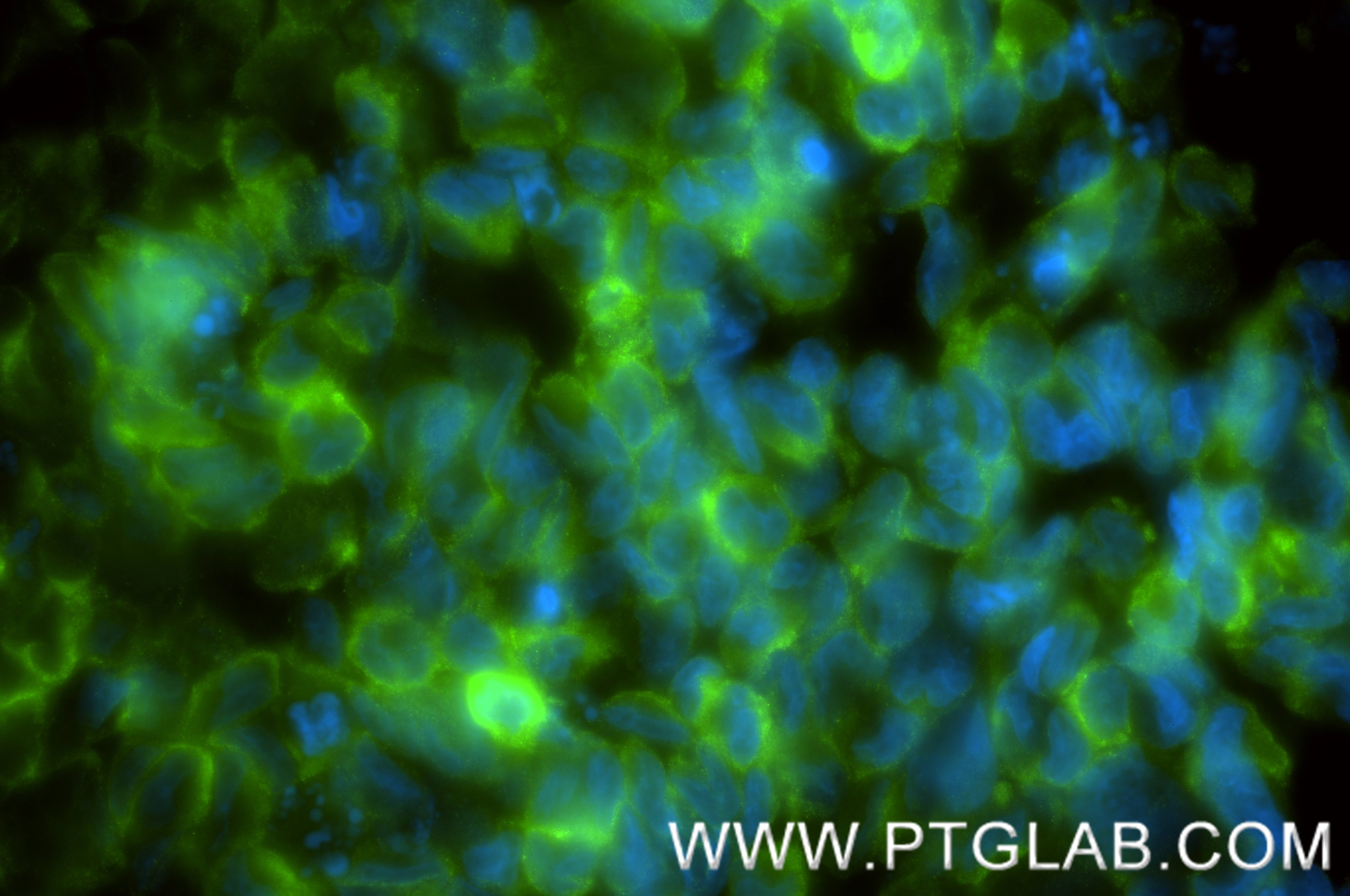 CCR7 antibody (86180-5-RR) | Proteintech | 武汉三鹰生物技术有限公司