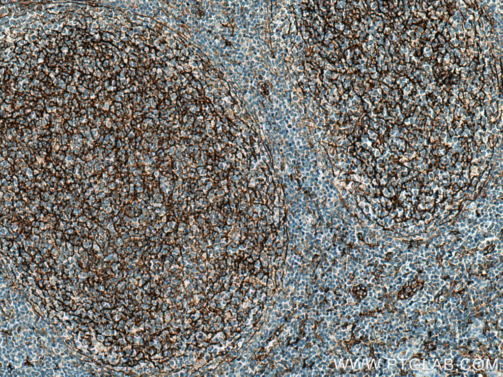 CD14 antibody (17000-1-AP) | Proteintech | 武汉三鹰生物技术有限公司
