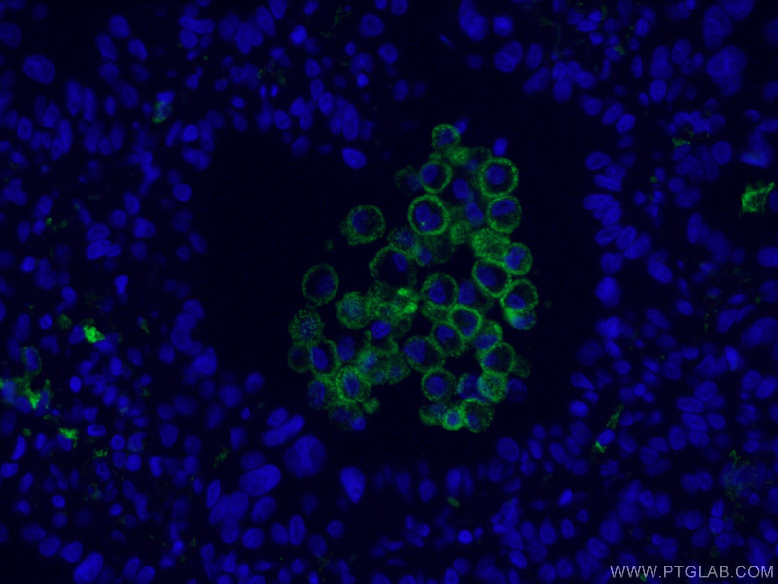 CD206 antibody (CL488-60143) | Proteintech