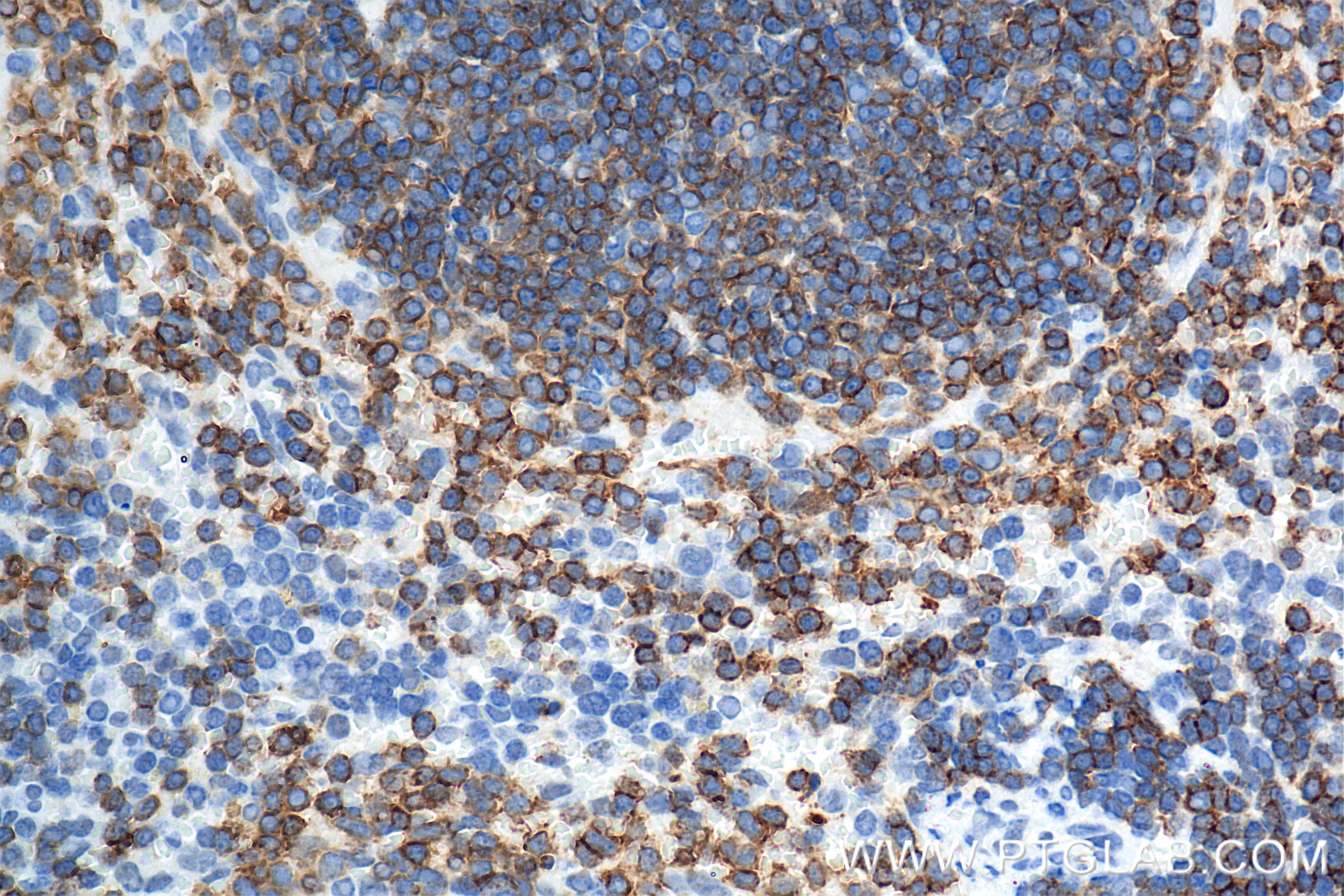 CD22 antibody (86128-1-PBS) | Proteintech | 武汉三鹰生物技术有限公司