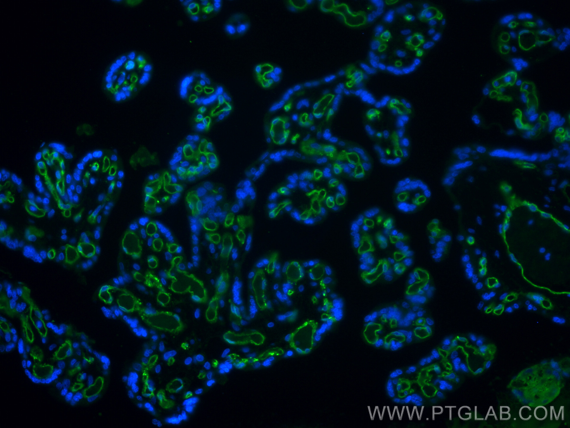CD31 antibody (66065-2-Ig) | Proteintech | 武汉三鹰生物技术有限公司