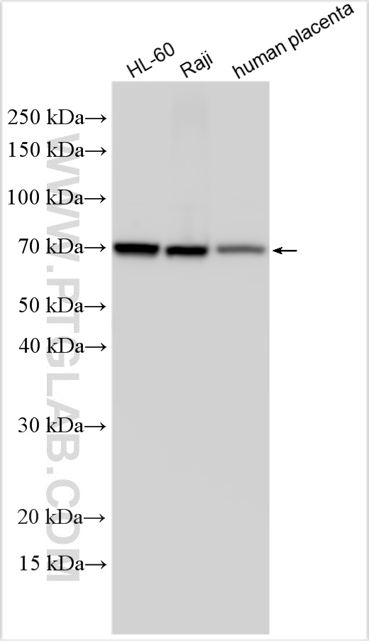 CD320 antibody (10343-1-AP) | Proteintech | 武汉三鹰生物技术有限公司
