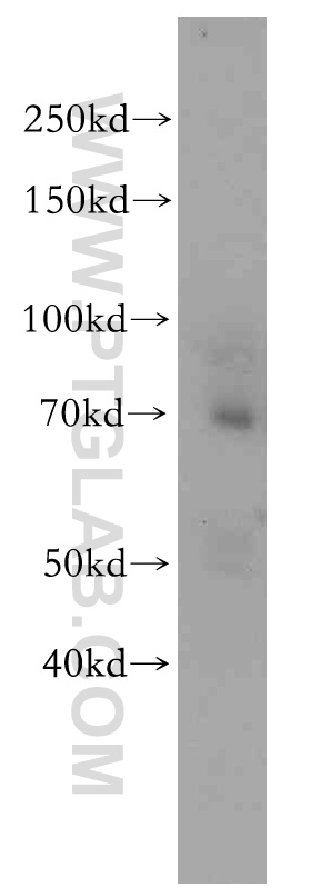 CD320 antibody (10343-1-AP) | Proteintech | 武汉三鹰生物技术有限公司