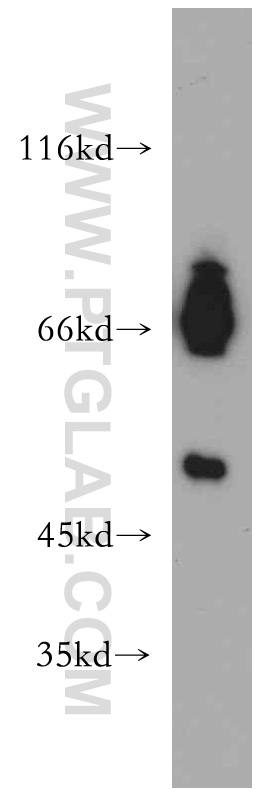 CD320 Antibody 10343-1-AP | Proteintech
