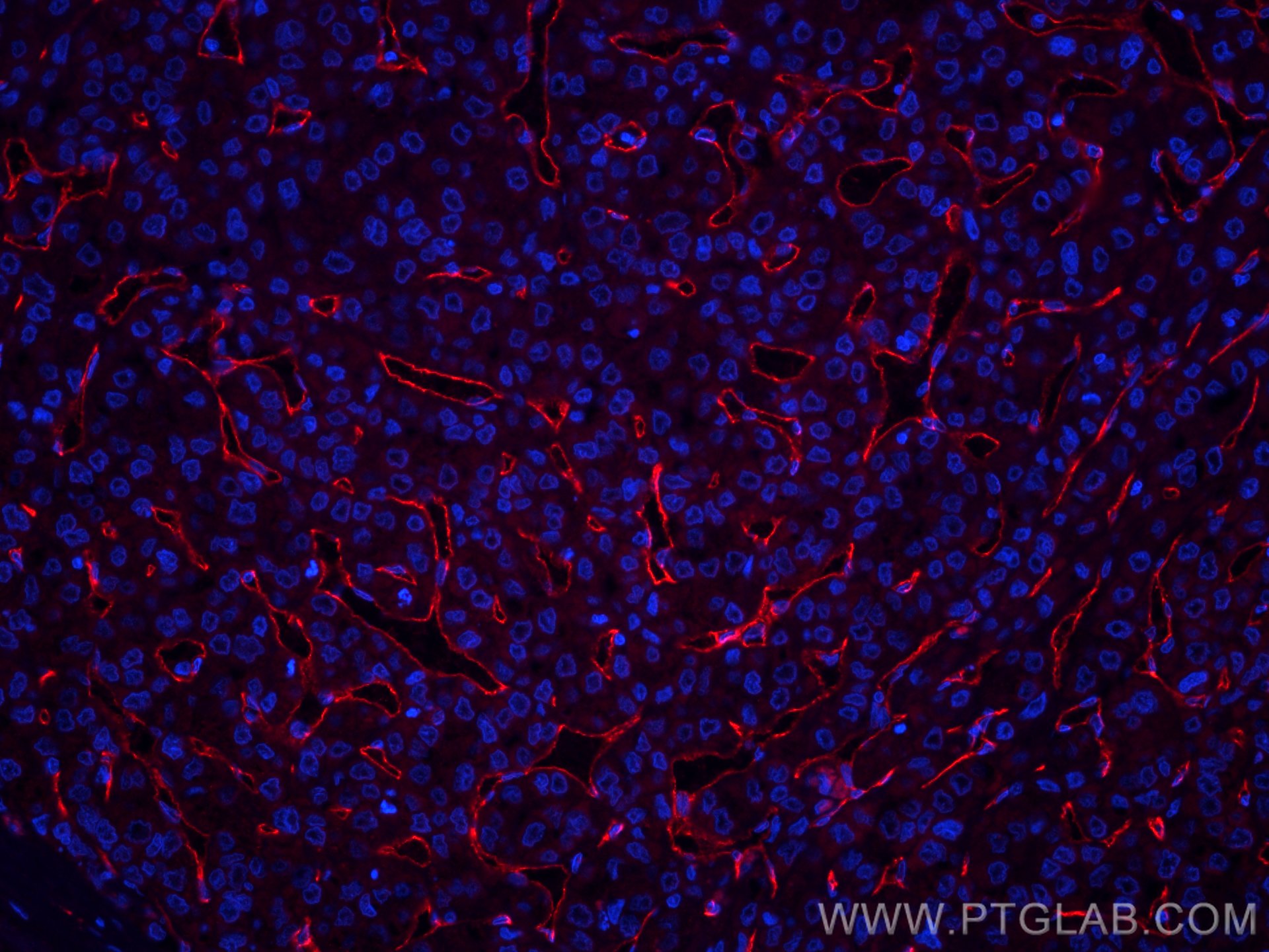 CD34 antibody (CL594-14486) | Proteintech | 武汉三鹰生物技术有限公司