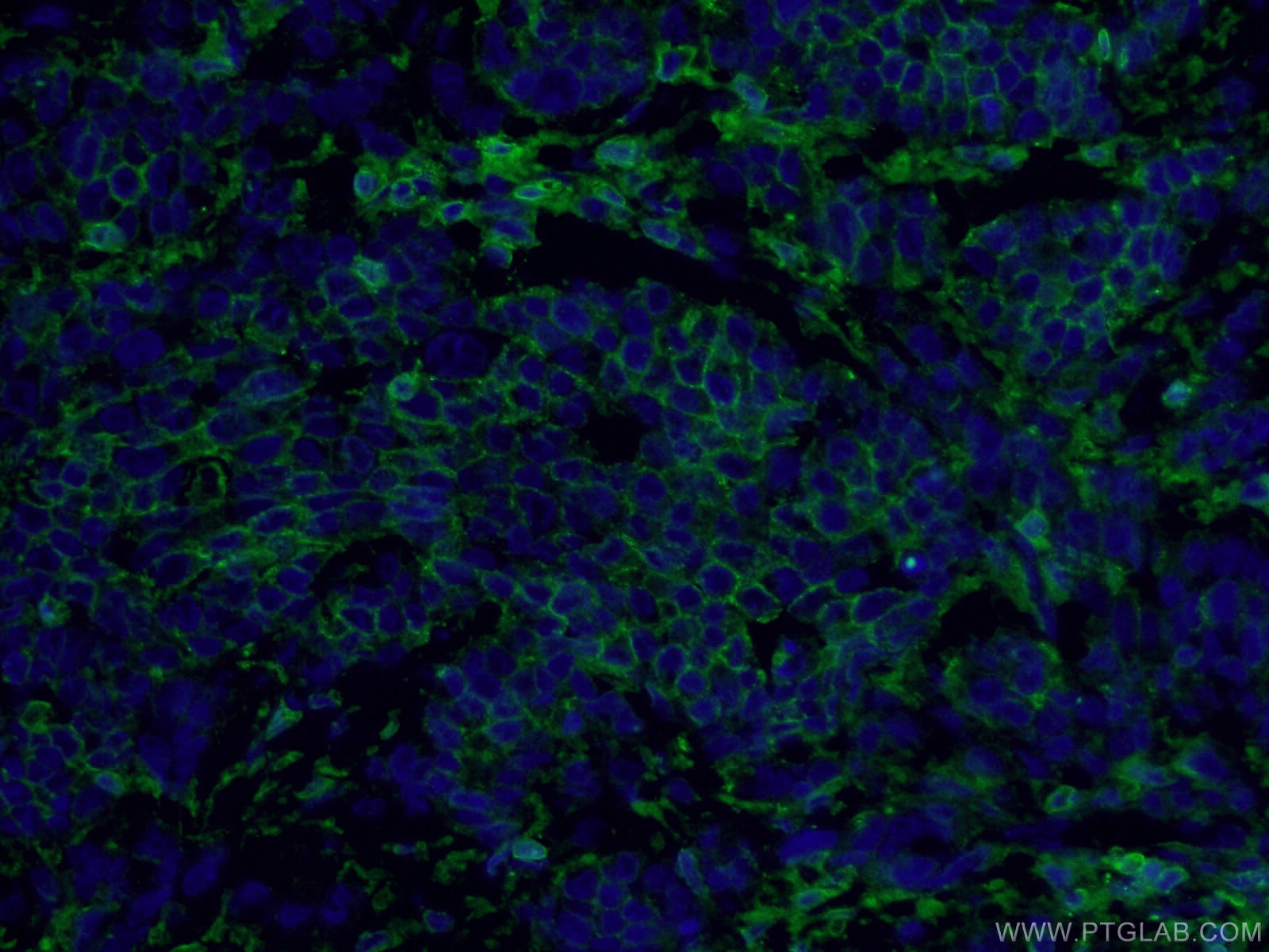 CD44 antibody (15675-1-AP) | Proteintech | 武汉三鹰生物技术有限公司