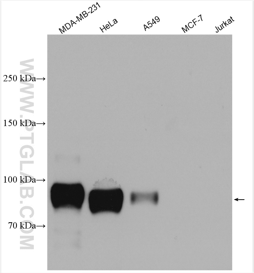 CD44 antibody (15675-1-AP) | Proteintech | 武汉三鹰生物技术有限公司