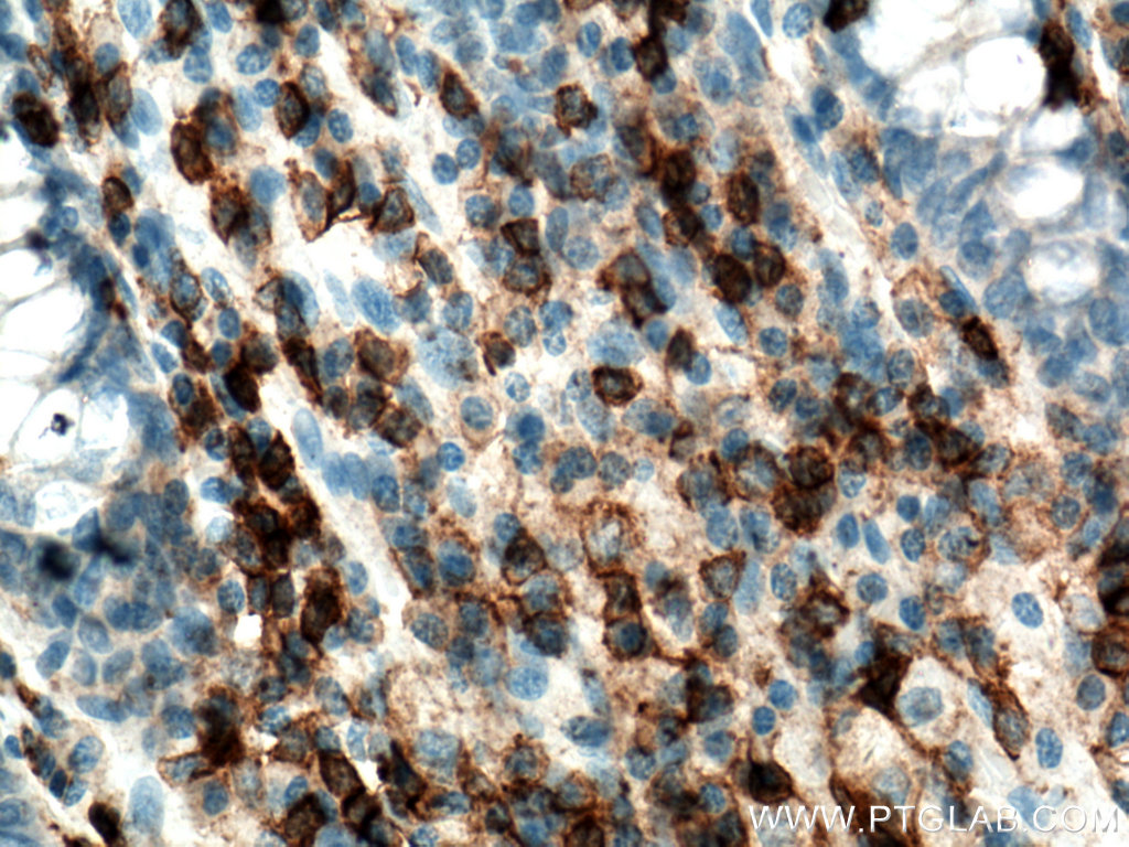 CD45 Antibody 60287-1-Ig | Proteintech