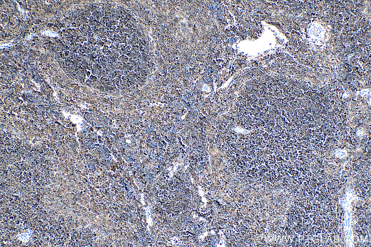 CD45 antibody (80297-1-RR) | Proteintech | 武汉三鹰生物技术有限公司