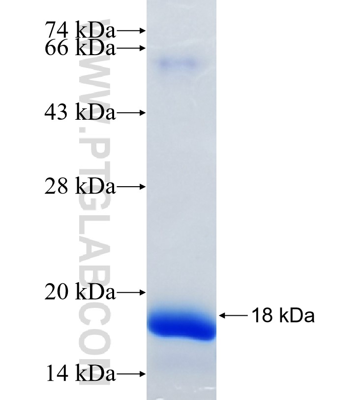 Results for "CD55" | Proteintech Group | 武汉三鹰生物技术有限公司