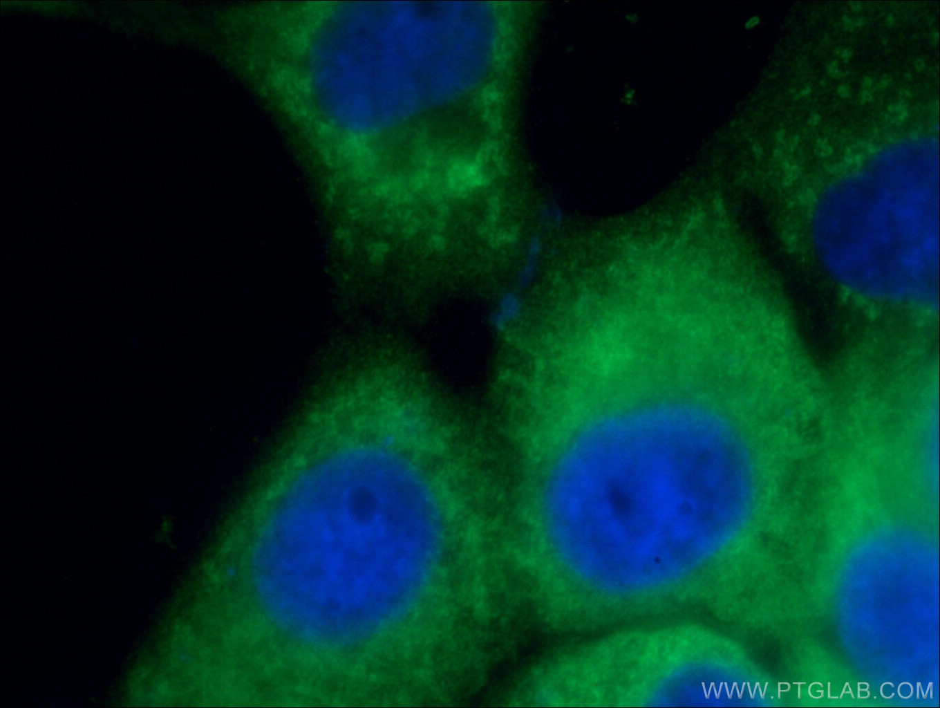 CD63 Antibody 25682-1-AP | Proteintech