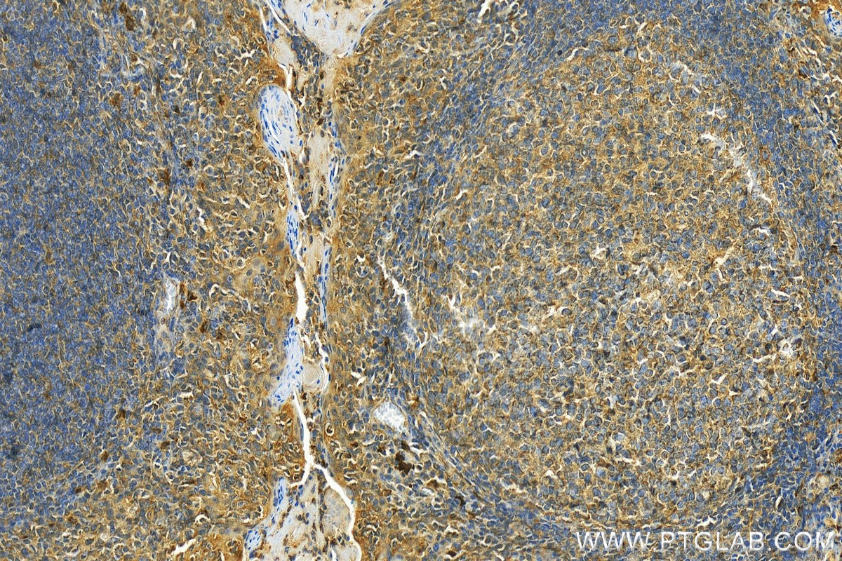 CD86 antibody (13395-1-AP) | Proteintech | 武汉三鹰生物技术有限公司