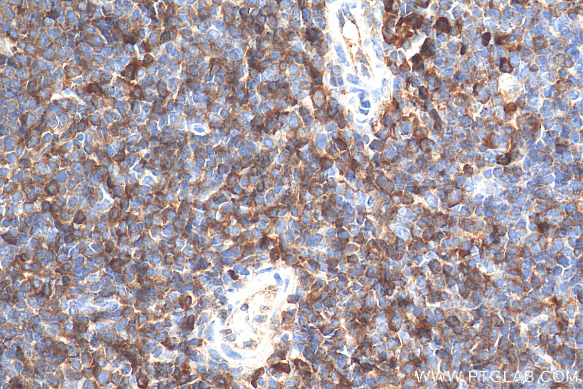 CD8a antibody (29896-1-AP) | Proteintech | 武汉三鹰生物技术有限公司