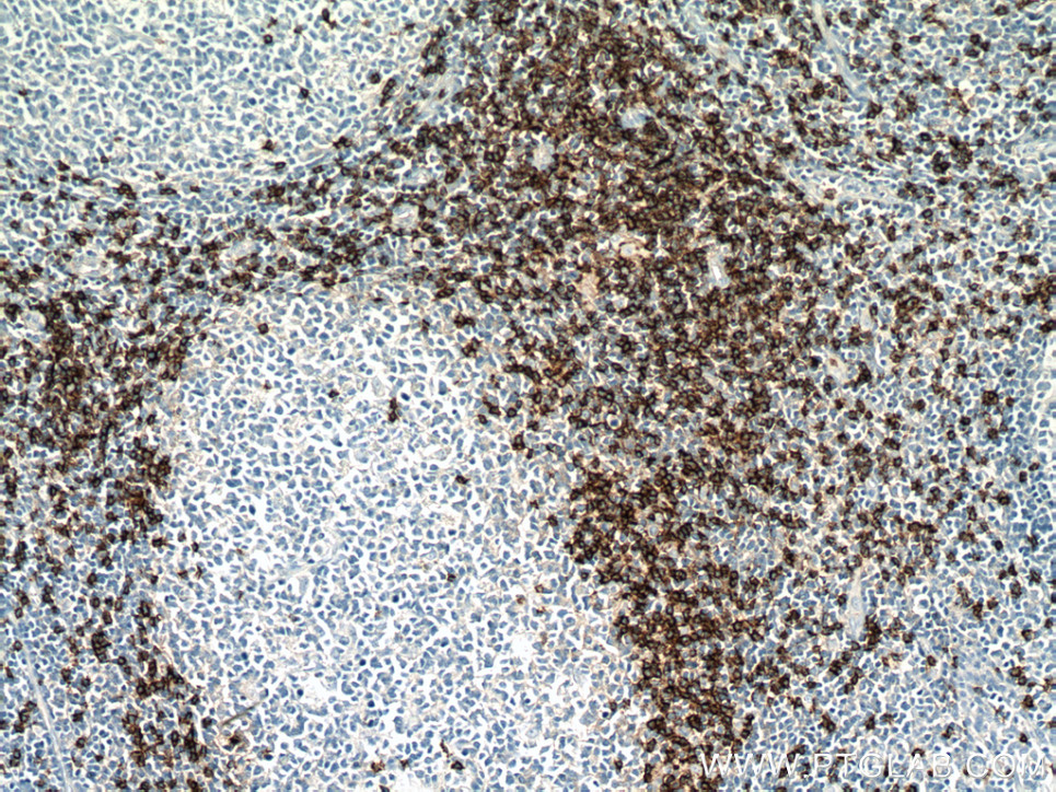 CD8 antibody (66868-1-Ig) | Proteintech