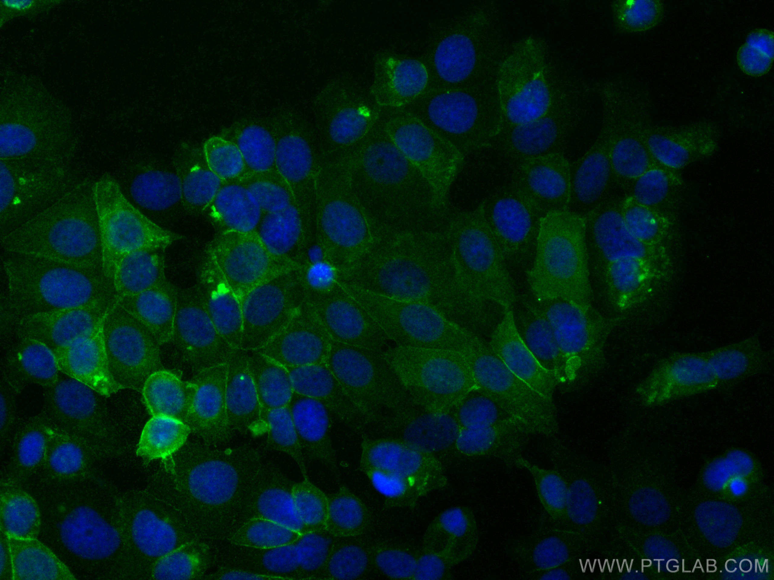 CD9 antibody (82105-1-RR) | Proteintech | 武汉三鹰生物技术有限公司