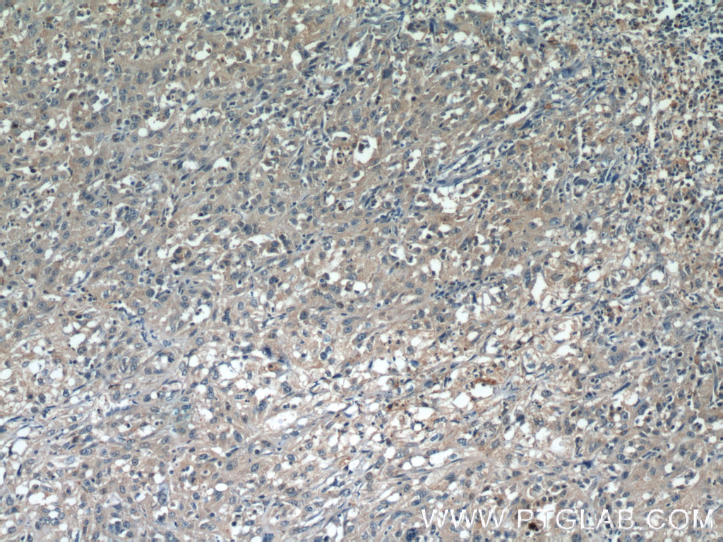 Cdca3 Antibody 15594 1 Ap Proteintech 武汉三鹰生物技术有限公司