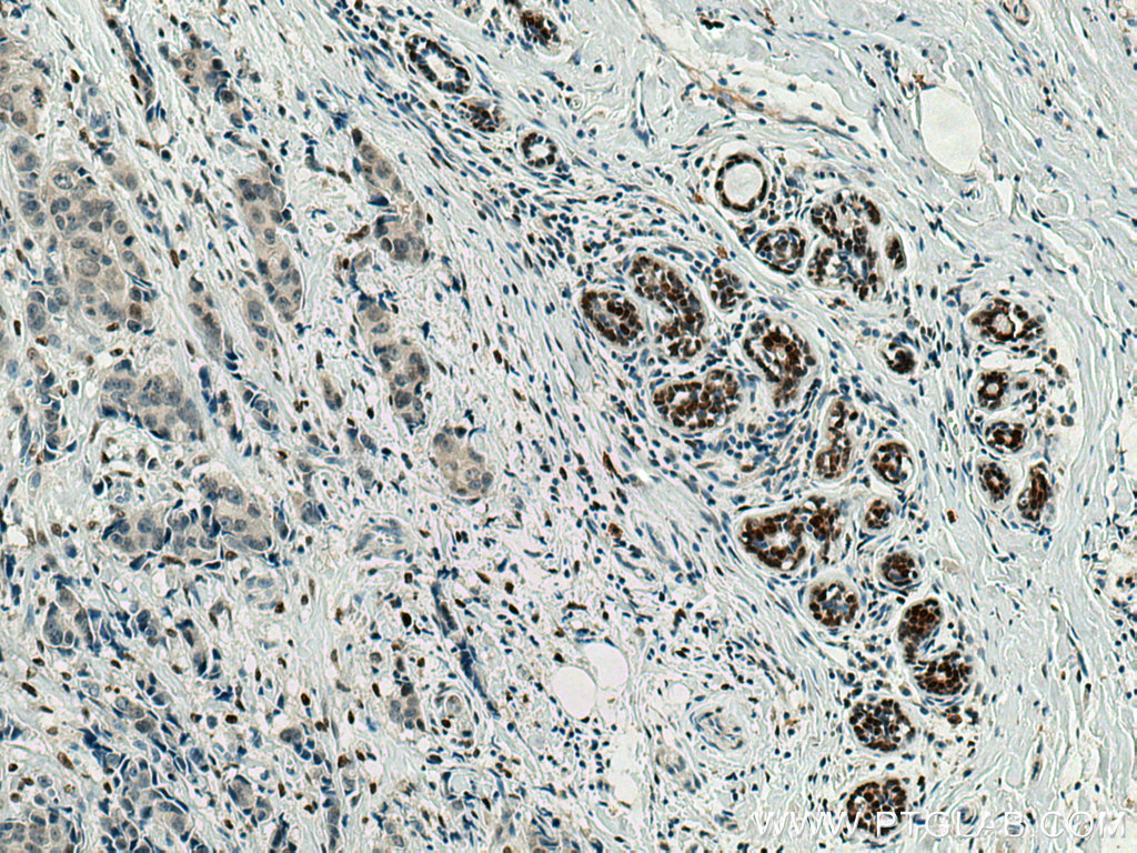 CEBPB antibody (23431-1-AP) | Proteintech | 武汉三鹰生物技术有限公司