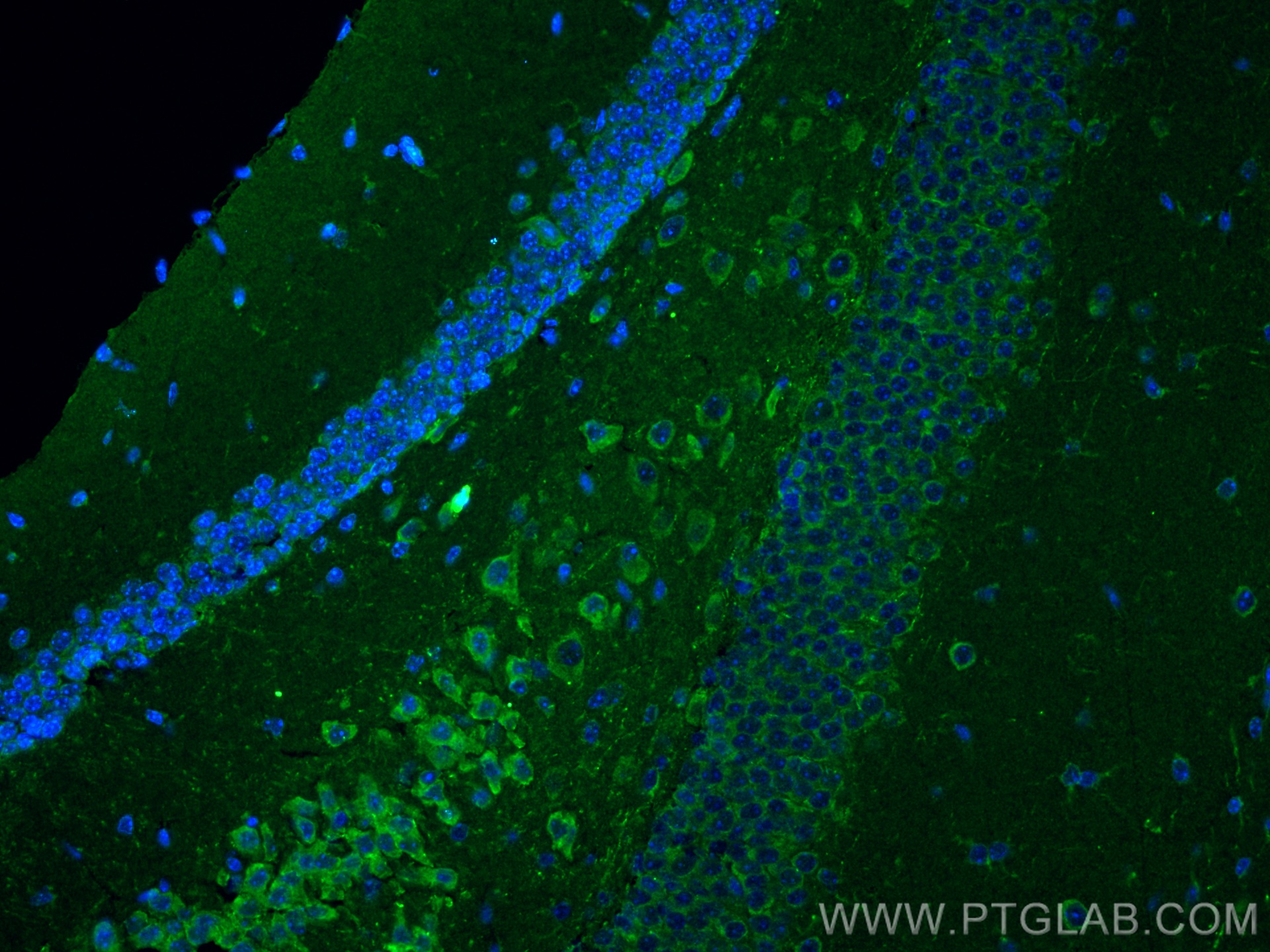 CHAT antibody (20747-1-AP) | Proteintech | 武汉三鹰生物技术有限公司