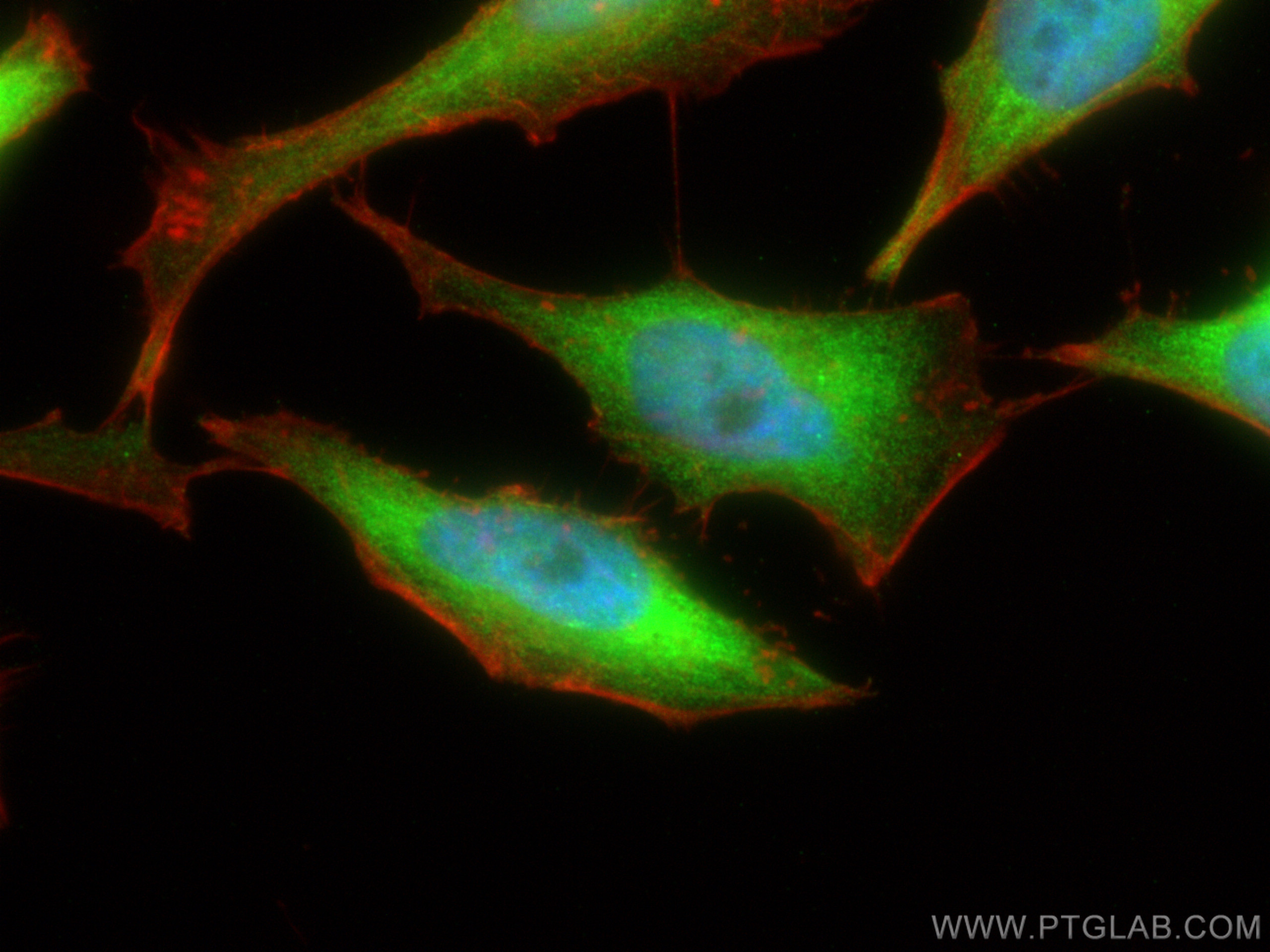 CHD3 antibody (25335-1-AP) | Proteintech | 武汉三鹰生物技术有限公司