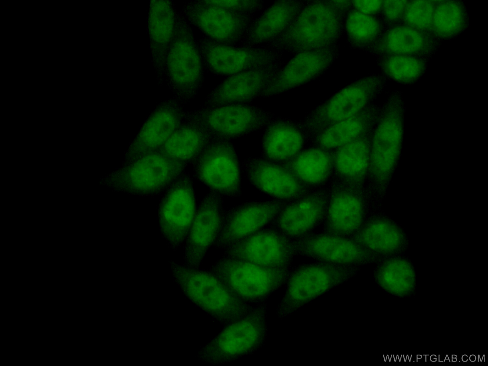 CHD9 antibody (13402-1-AP) | Proteintech | 武汉三鹰生物技术有限公司
