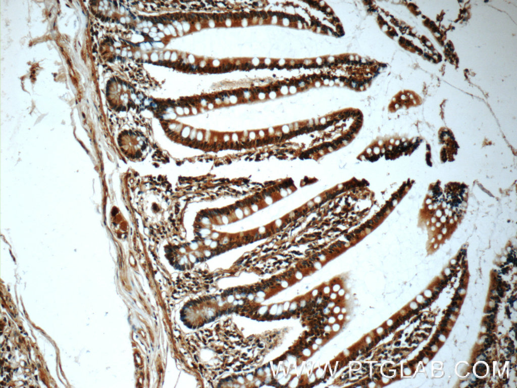 Chk1 Antibody 60277-1-Ig | Proteintech
