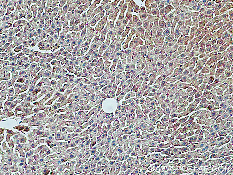 CIDEB Fusion Protein Ag26993 | Proteintech | 武汉三鹰生物技术有限公司