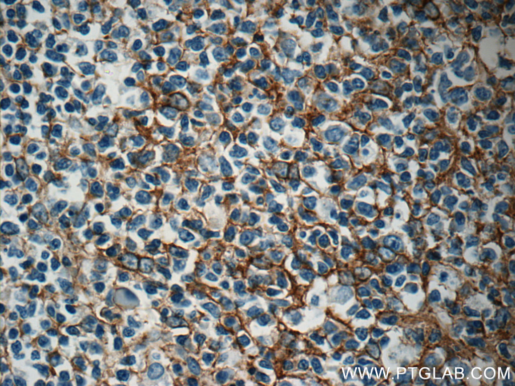 Clusterin Antibody 12289-1-AP | Proteintech