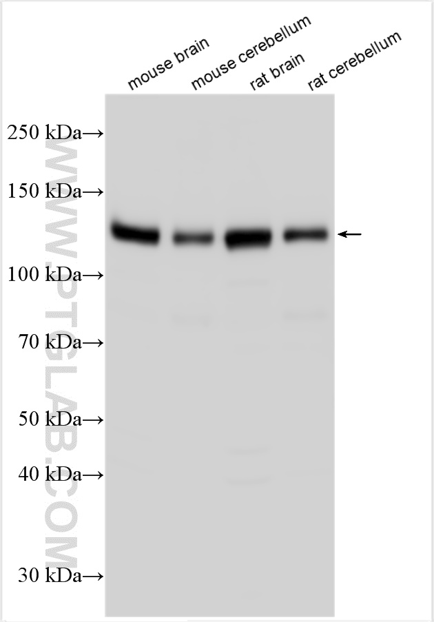 CNTN1 antibody (13843-1-AP) | Proteintech | 武汉三鹰生物技术有限公司