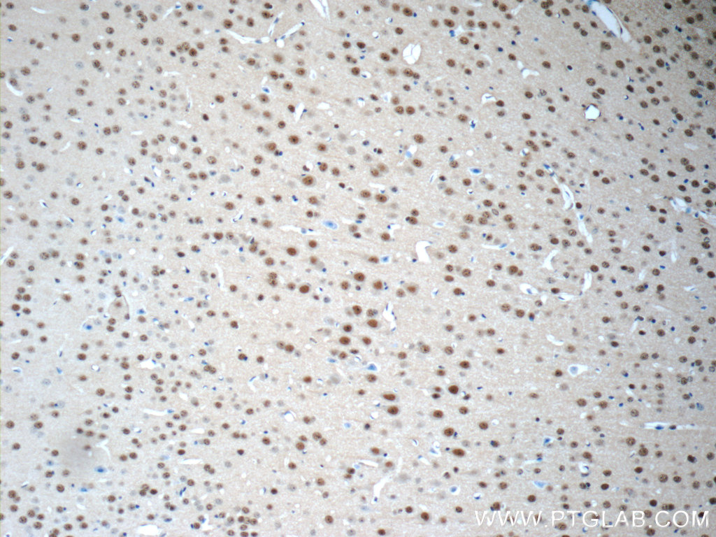 COPS8/COP9 antibody (10089-2-AP) | Proteintech | 武汉三鹰生物技术有限公司