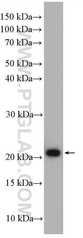 COPS8/COP9 antibody (10089-2-AP) | Proteintech | 武汉三鹰生物技术有限公司