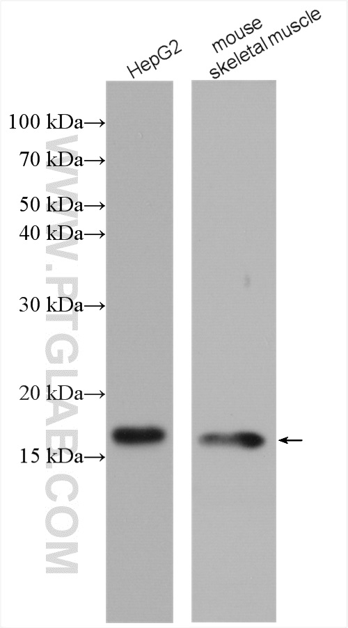 COXIV antibody (11242-1-AP) | Proteintech