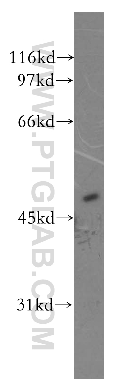 CPN1 antibody (13385-1-AP) | Proteintech | 武汉三鹰生物技术有限公司