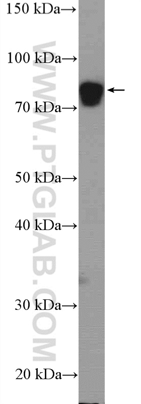CPT1B-specific Antibody 22170-1-AP | Proteintech