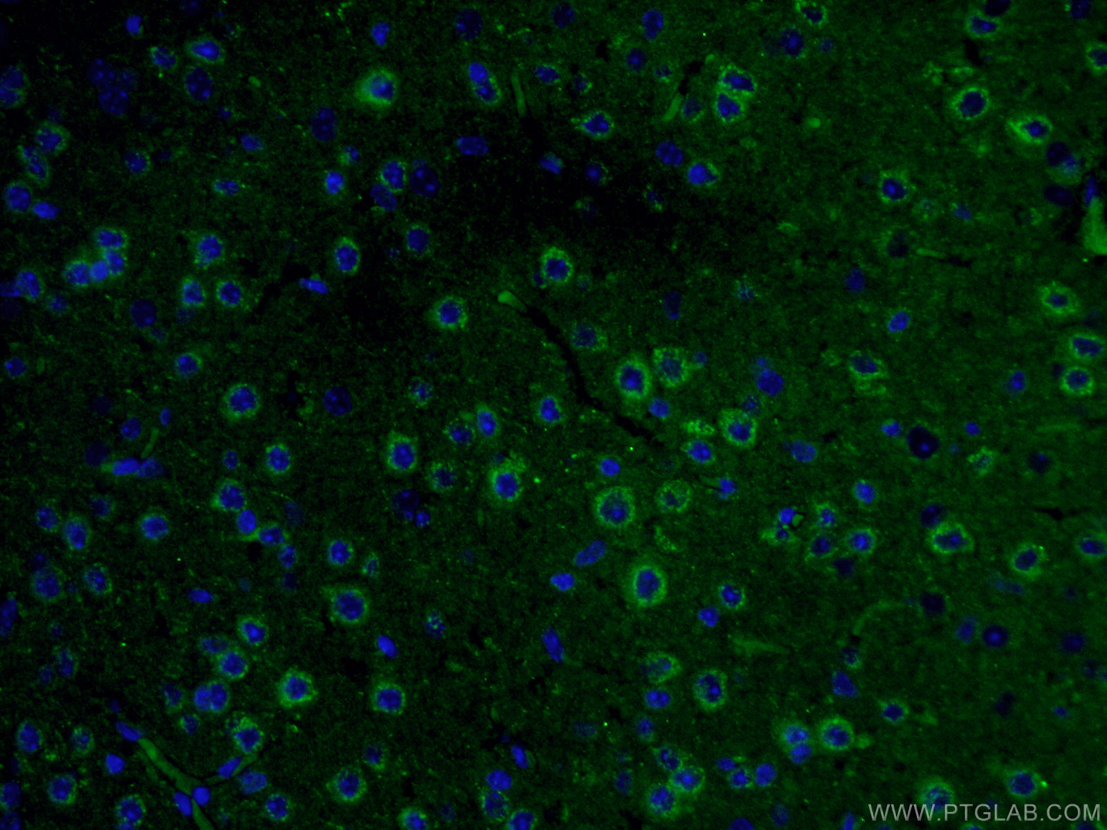 CRH/CRF antibody (10944-1-AP) | Proteintech | 武汉三鹰生物技术有限公司