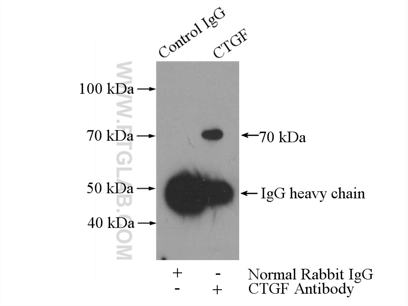 CTGF antibody (23903-1-AP) | Proteintech | 武汉三鹰生物技术有限公司