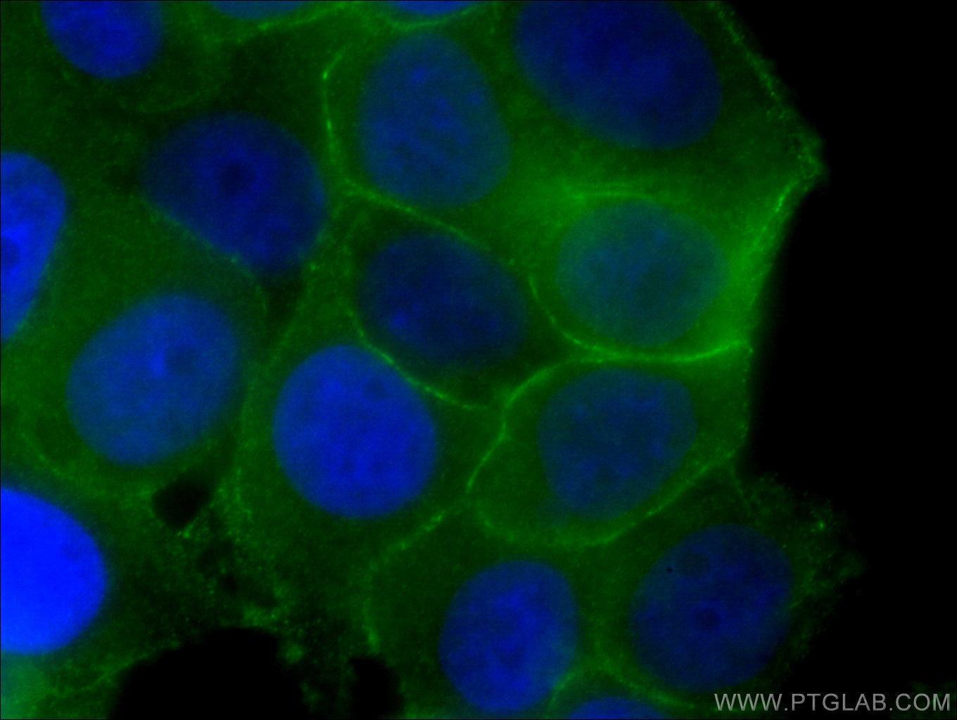 p120 Catenin antibody (66208-1-Ig) | Proteintech | 武汉三鹰生物技术有限公司