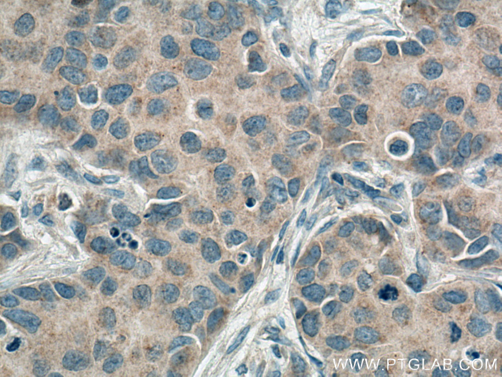 CXCL1 Antibody 12335-1-AP | Proteintech