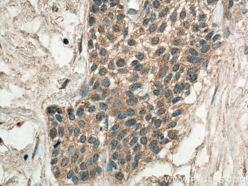 CXCL1 Antibody 12335-1-AP | Proteintech