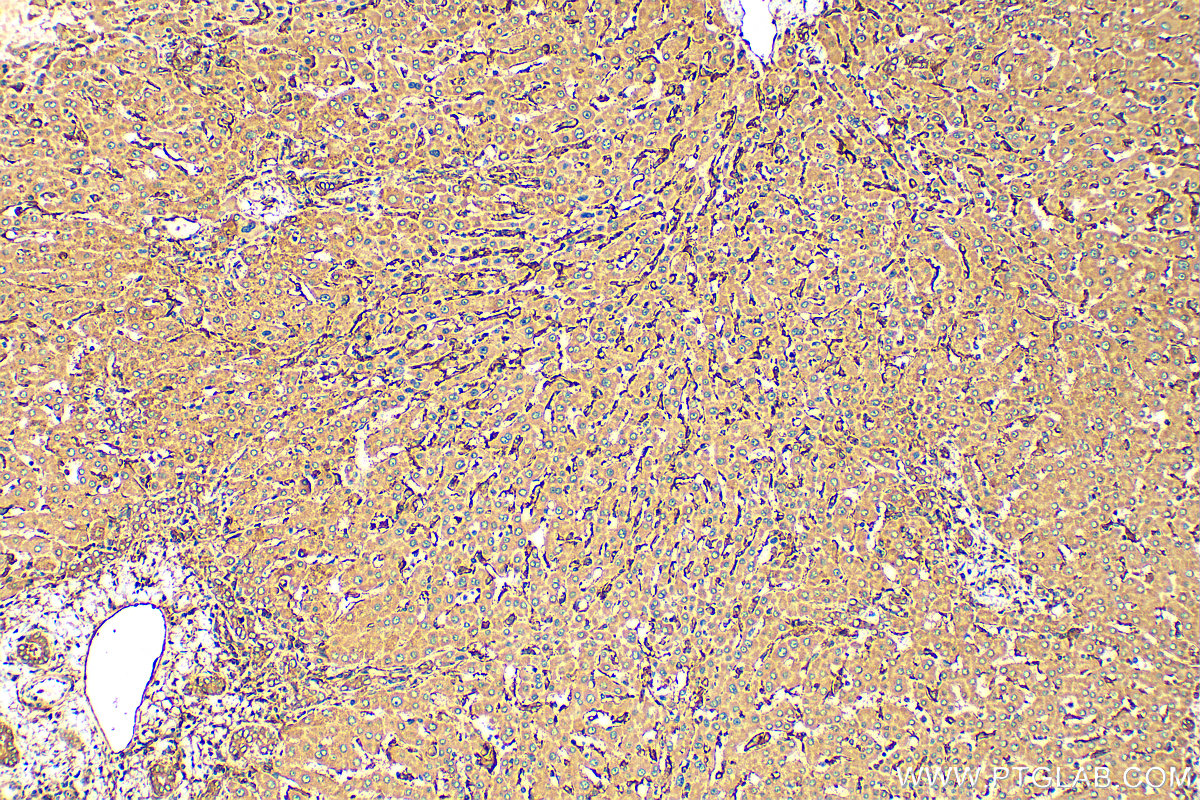 CXCL10/IP-10 antibody (10937-1-AP) | Proteintech | 武汉三鹰生物技术有限公司