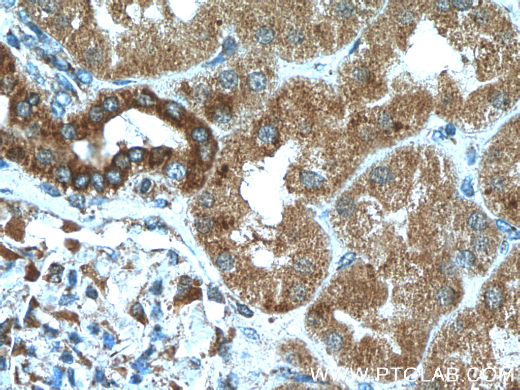 CXCR3 antibody (26756-1-AP) | Proteintech | 武汉三鹰生物技术有限公司