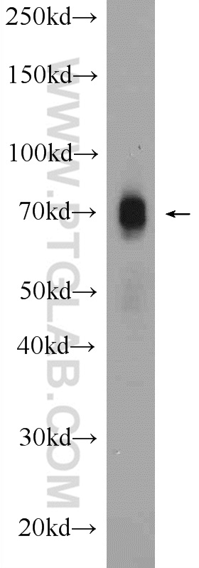 CCR5 antibody (17476-1-AP) | Proteintech