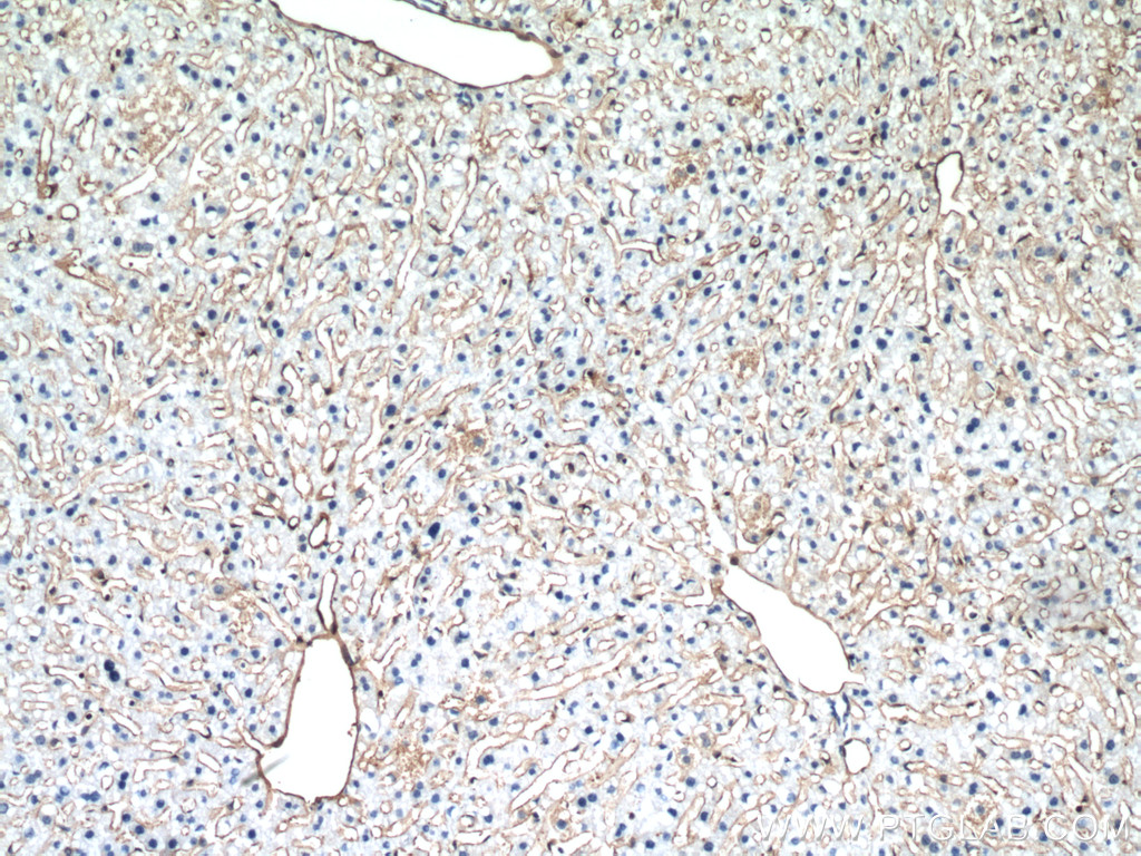 CD31 antibody (28083-1-AP) | Proteintech | 武汉三鹰生物技术有限公司