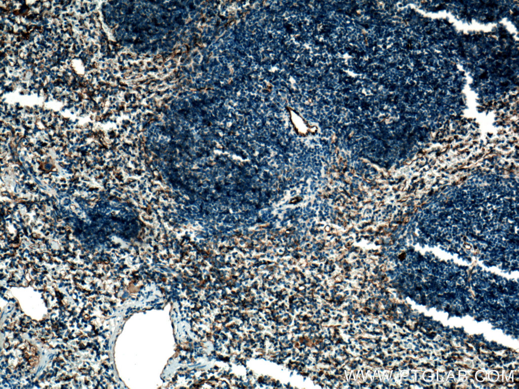 Cd31 antibody (28083-1-AP) | Proteintech
