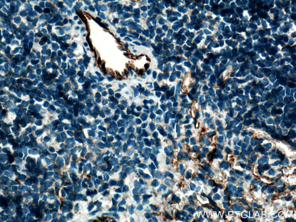 Cd31 antibody (28083-1-AP) | Proteintech