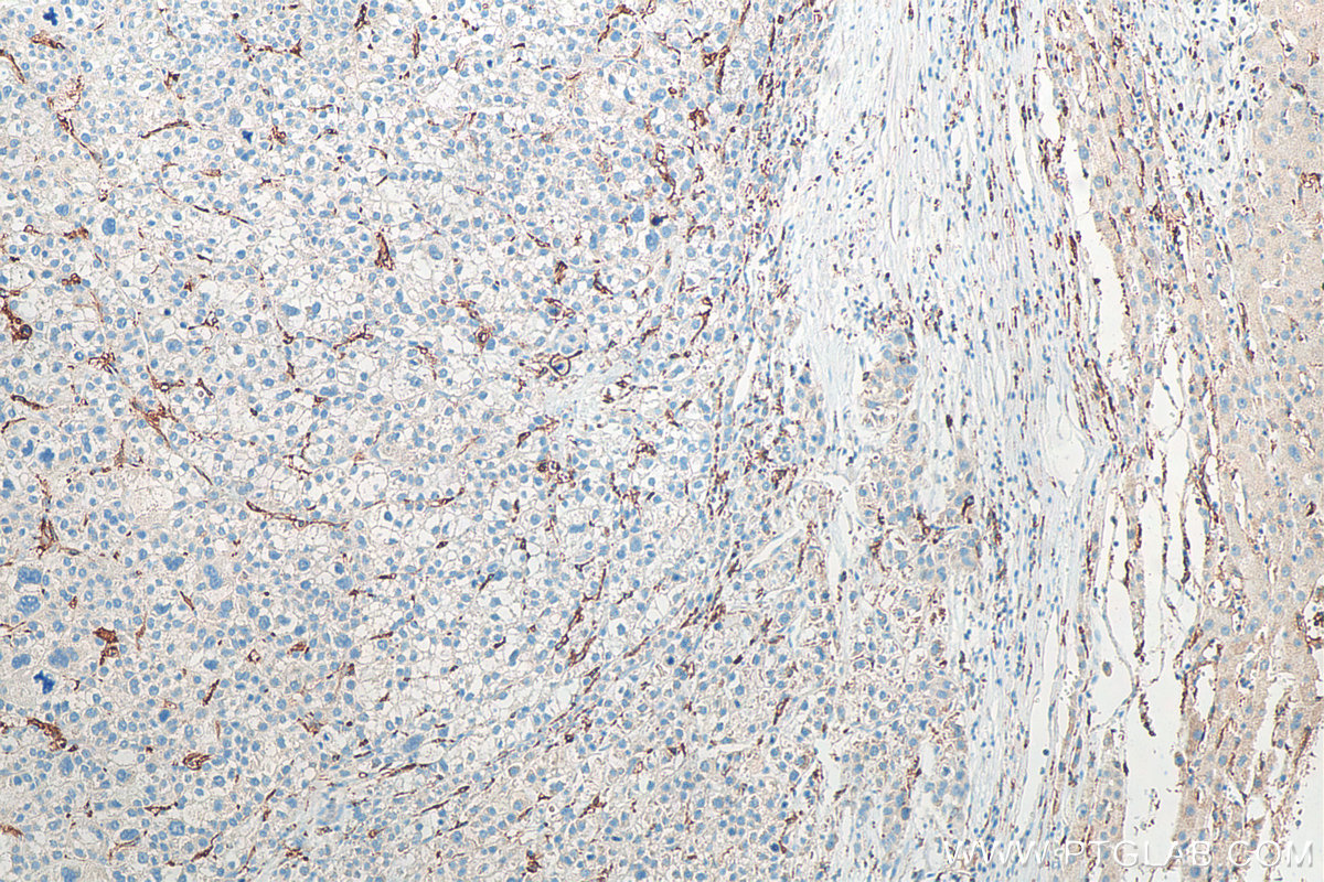 CD31 antibody (28083-1-AP) | Proteintech | 武汉三鹰生物技术有限公司